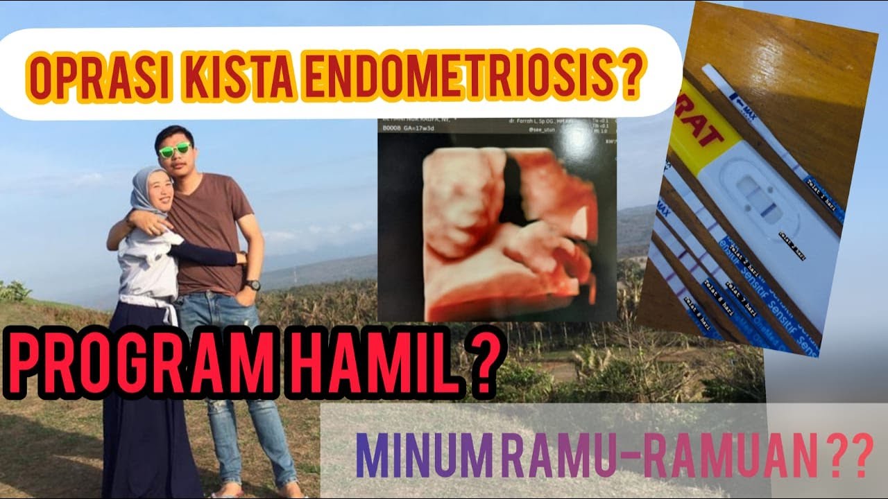 PROGRAM HAMIL SETELAH OPERASI KISTA ENDOMETRIOSIS | RANDY & BETTY - YouTube