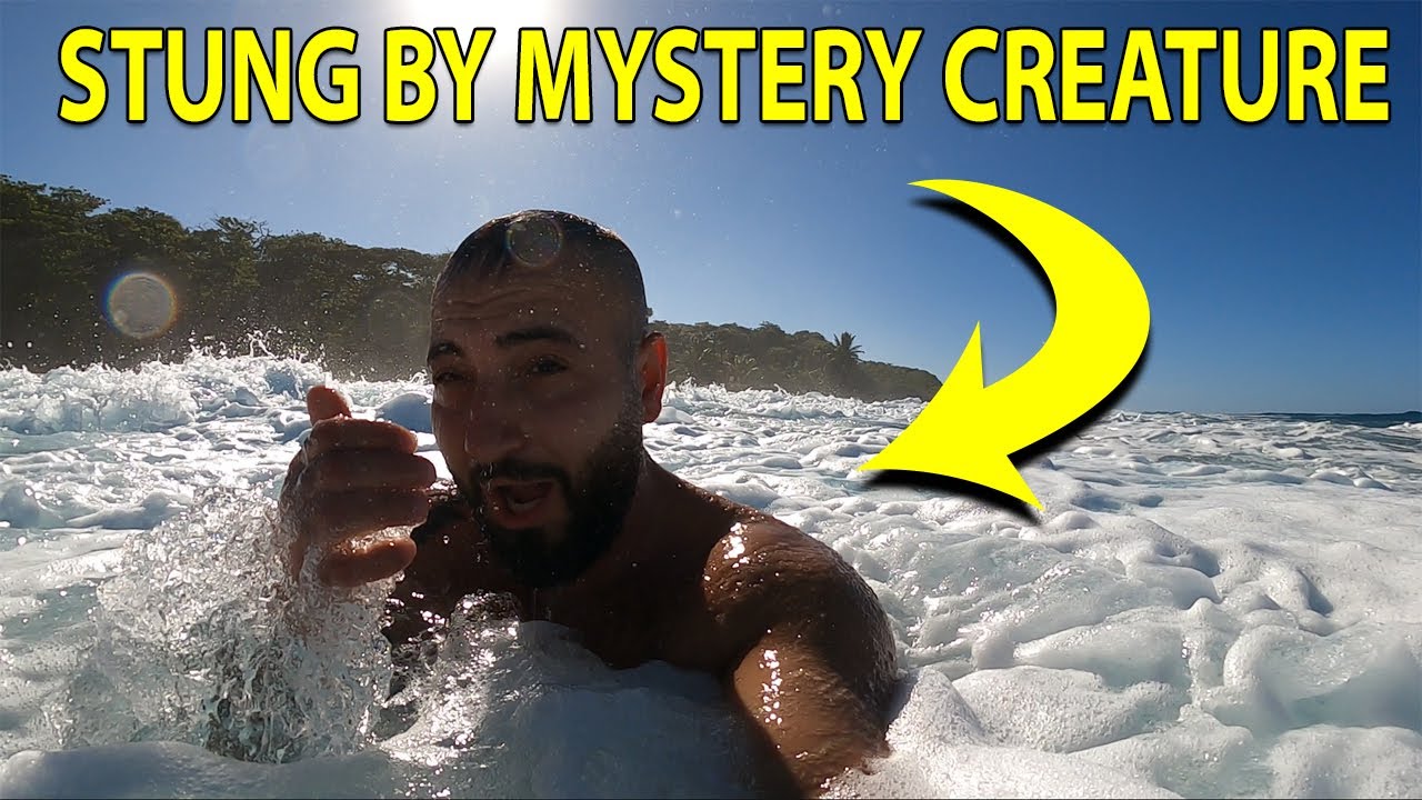 STUNG BY A MYSTEROUS CREATURE IN THE OCEAN - YouTube