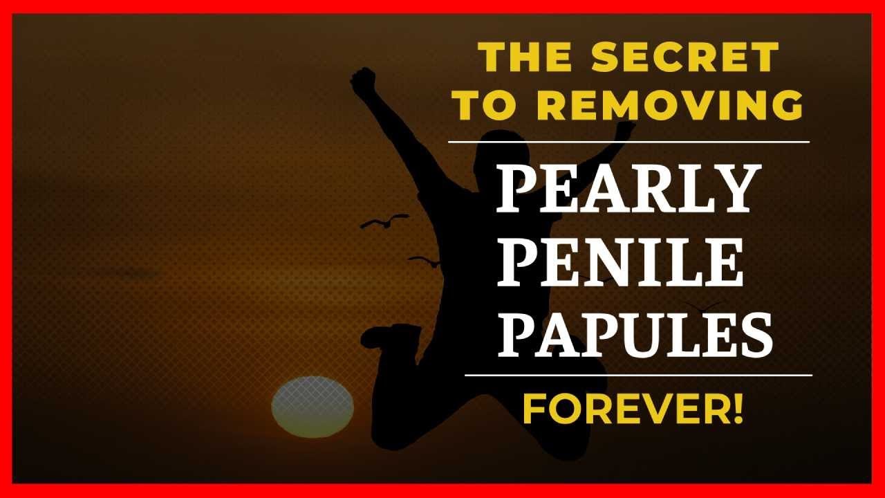 Papules How To Get Rid | What You Should Know - YouTube