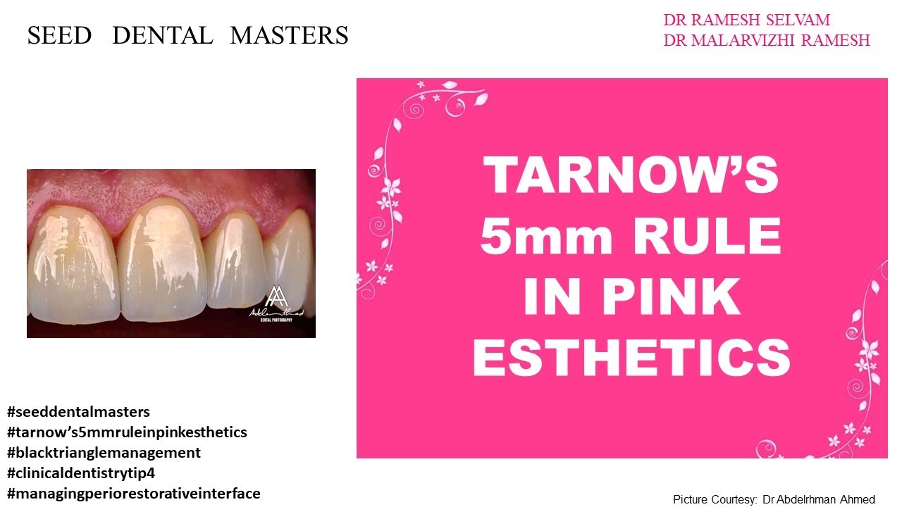 SEED DENTAL MASTERS - TARNOW'S 5MM RULE IN PINK ESTHETICS - YouTube