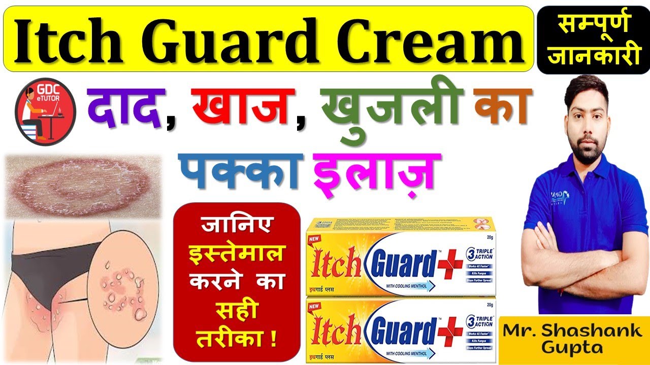 Itch Gaurd Cream की सम्पूर्ण जानकारी | दाद, खाज, खुजली का पक्का इलाज़ # ...