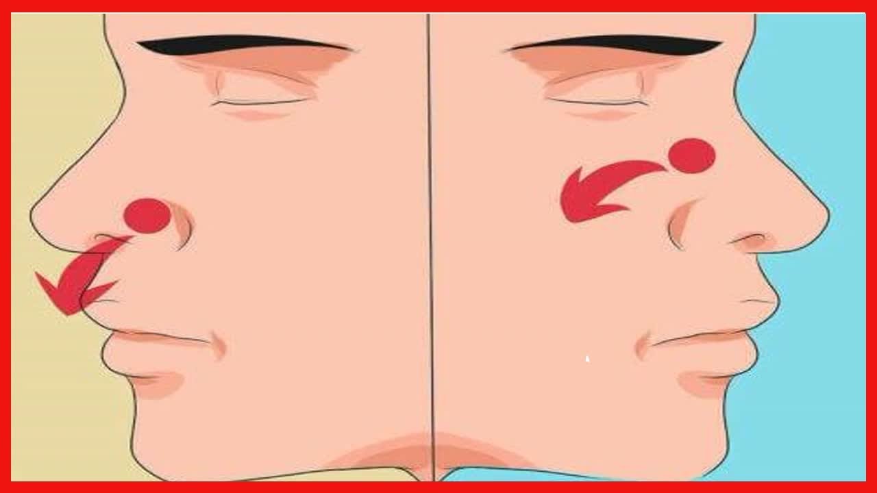 Hiperosmia, a sensibilidade excessiva a odores - YouTube