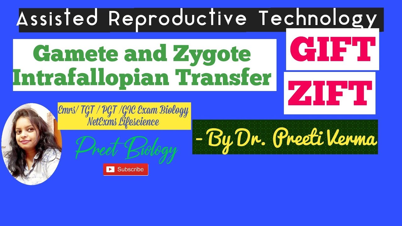 Gamete And Zygote Intrafallopian Transfer Ll GIFT Ll ZIFT Ll IVF Ll gamete-and-zygote-intrafallopian-transfer-ll-gift-ll-zift-ll-ivf-ll