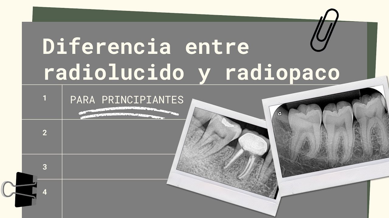 Diferencia entre radiopaco y radiolucido dental - YouTube
