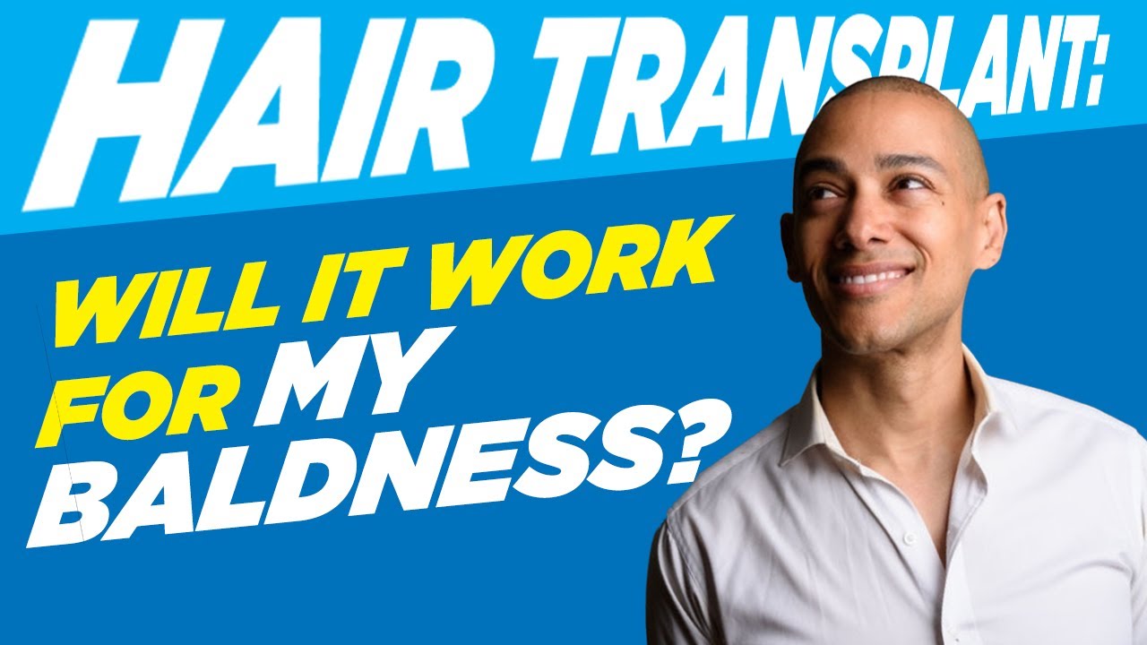 Do Hair Transplants Really Work? | Dr. Gaurang Krishna - Best Hair ...
