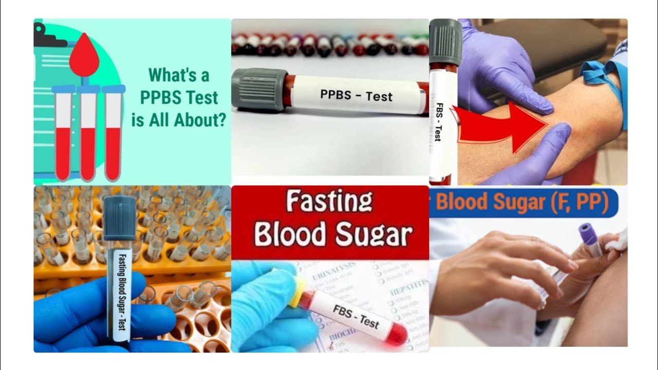 Blood collection by using vaccitainer method..closed system of blood ...