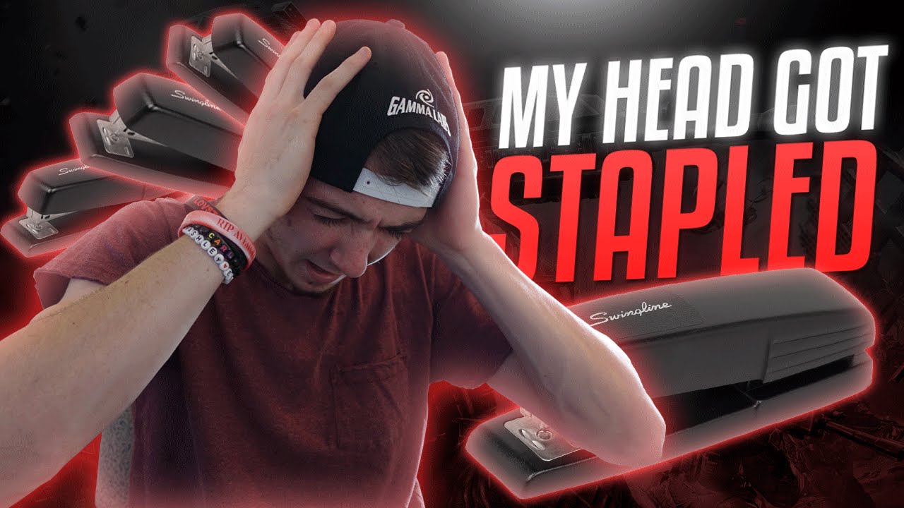 THEY STAPLED MY HEAD! - YouTube