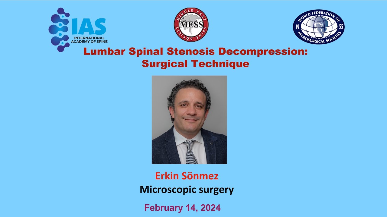 Microscopic decompression for lumbar spinal stenosis: Erkin Sönmez ...