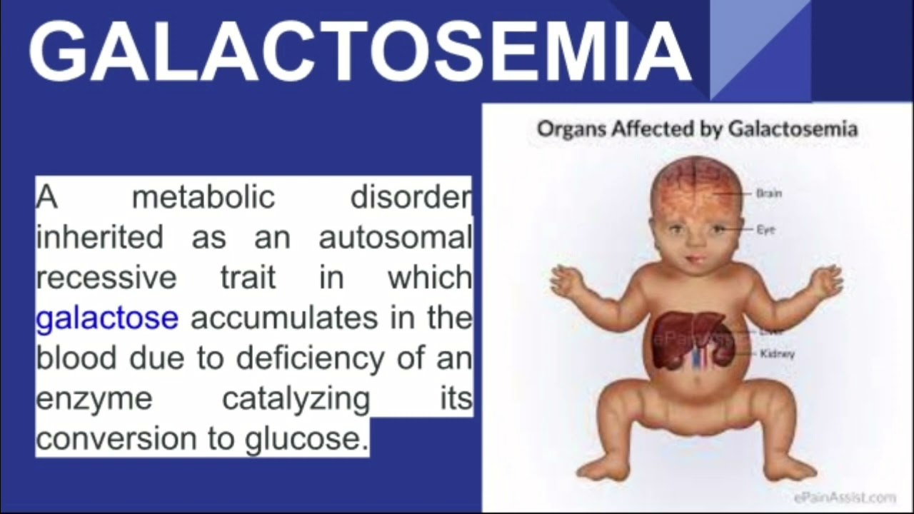 Galactosemia Symptoms