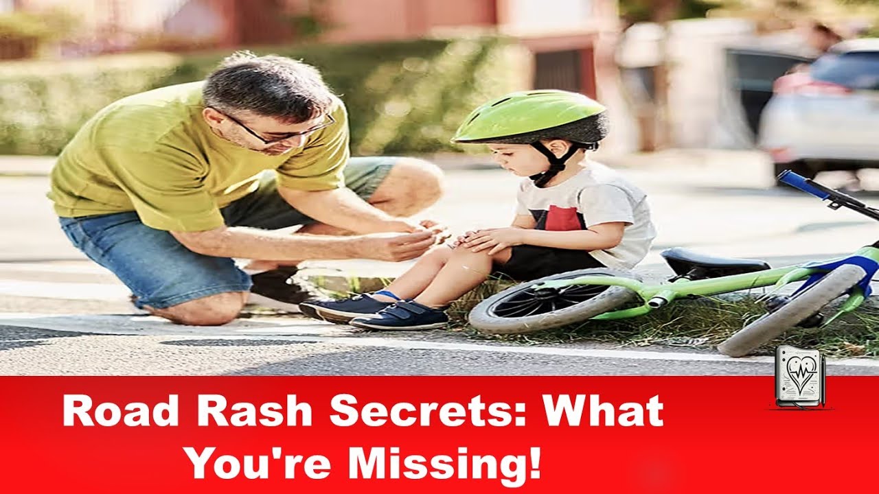 Road Rash: 7 Essential Tips You Need to Know for Faster Healing - YouTube