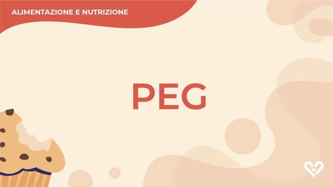 Gastrostomia endoscopica percutanea (PEG): in cosa consiste e quando ...