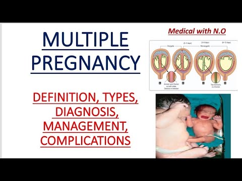 multiple pregnancy, causes, diagnosis, management, complications etc.# ...