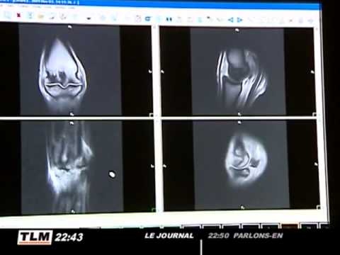 Un IRM pour les Chevaux (Ecole Nationale Vétérinaire de Ly - YouTube