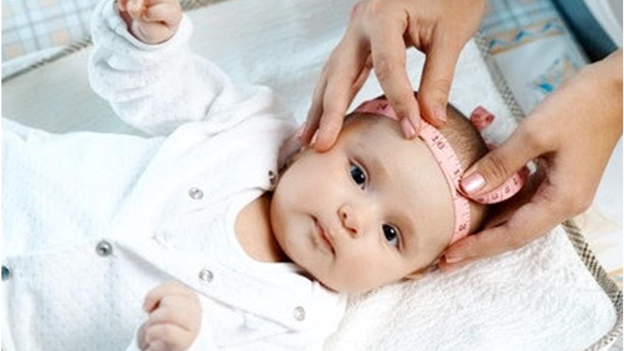 O que é macrocefalia, sintomas e tratamento | Kayo TV - YouTube