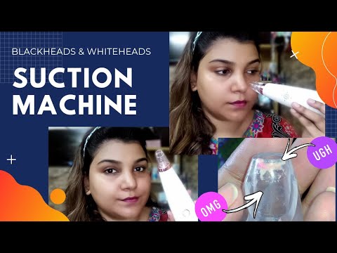 Blackhead And whitehead suction machine | How To Use Blackhead Vacuum ...