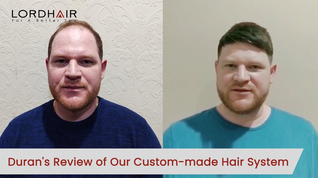 Custom Hair System Review: Duran Introduces His Custom-Made Mono ...