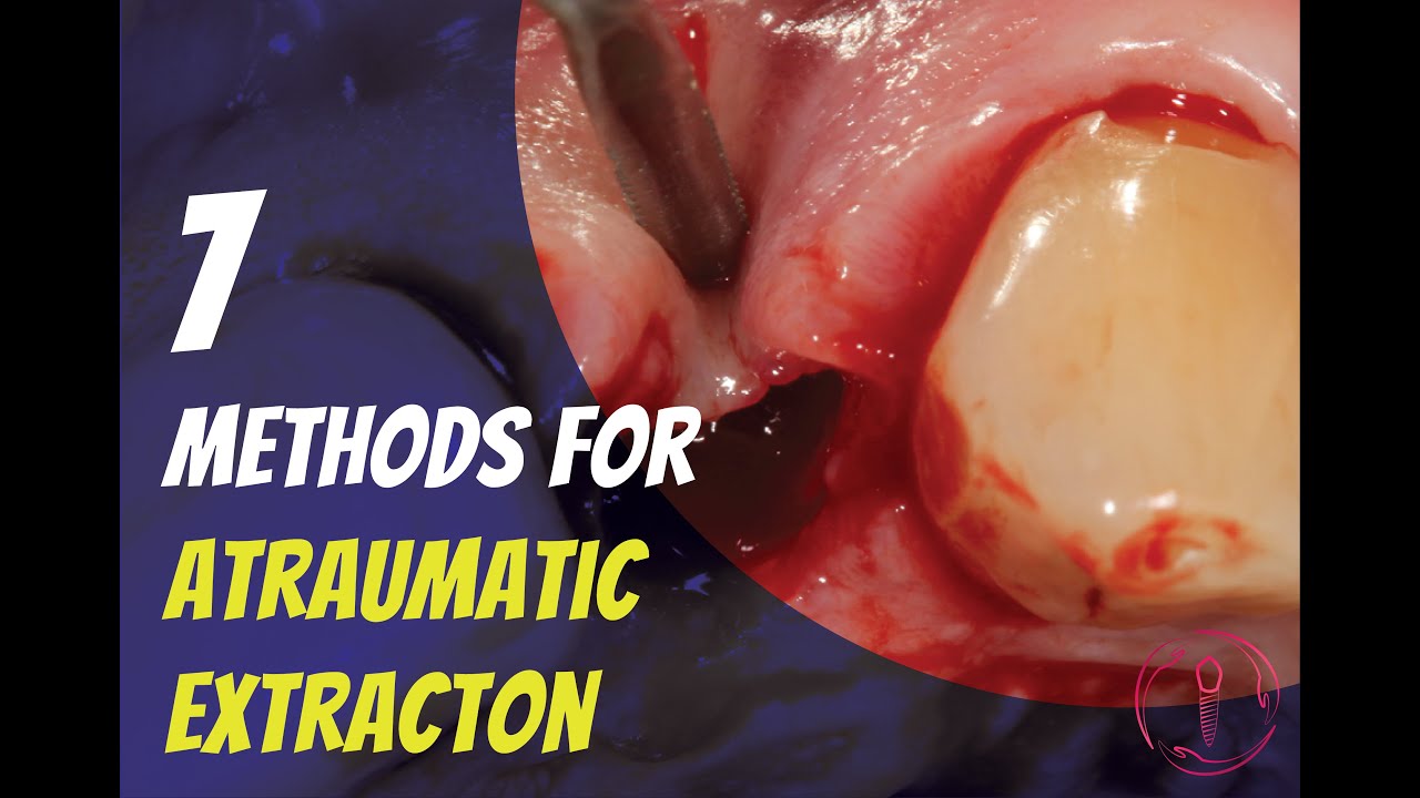 seven methods for Atraumatic Extraction - YouTube