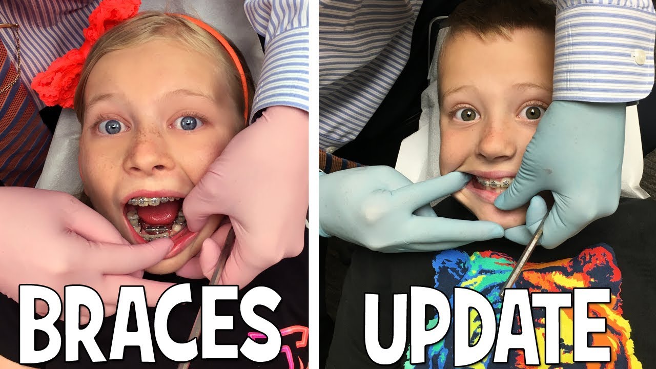 We Are Braces Twins Youtube