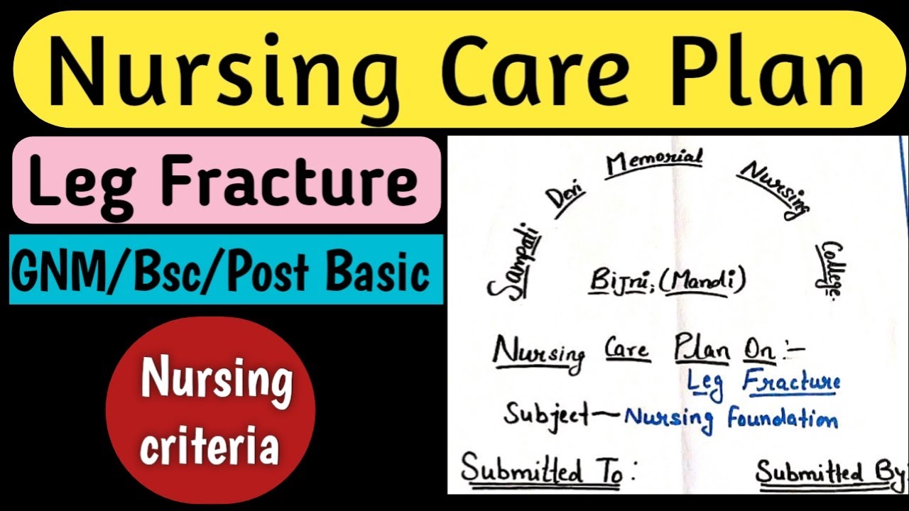 Nursing Care Plan on Leg Fracture #Fracture - YouTube