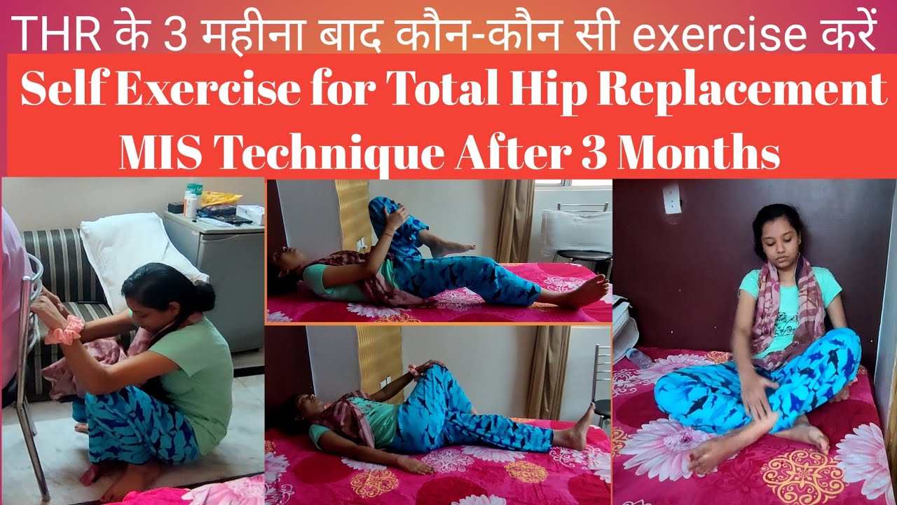 Self Exercise for Total Hip Replacement After 3 Months | THR के 3 महीने ...
