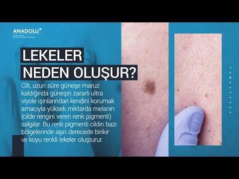 Vücuttaki kahverengi lekeler nasıl geçirilir?