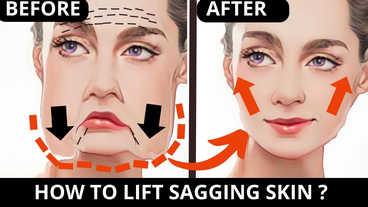 FACE LIFTING EXERCISES FOR JOWLS, SAGGY CHEEKS, ANTI-AGING | FACE YOGA ...