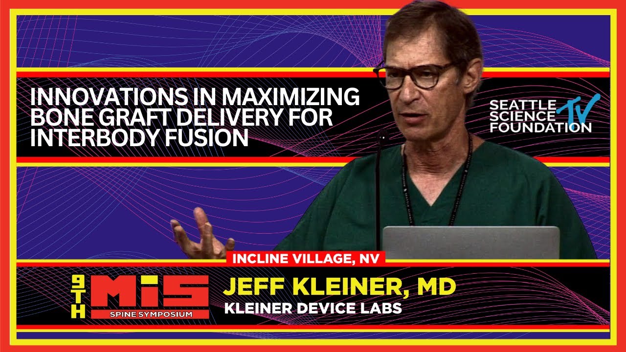 Innovations in Maximizing Bone Graft Delivery for Interbody Fusion ...