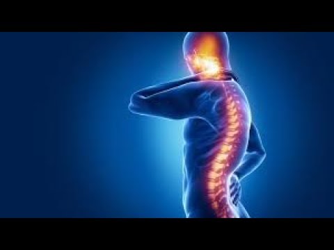 CBD (Cannabidiol) for spinal cord injury.. - YouTube