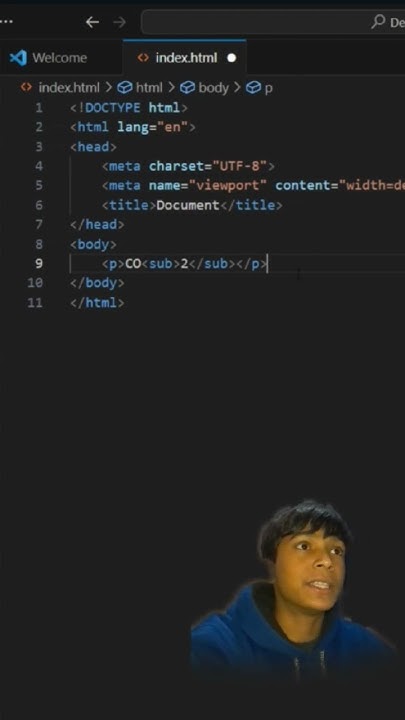 Day 9 Web Development Subsupviral Ytshortscodingvairalshort Webdevelopmentprogramming