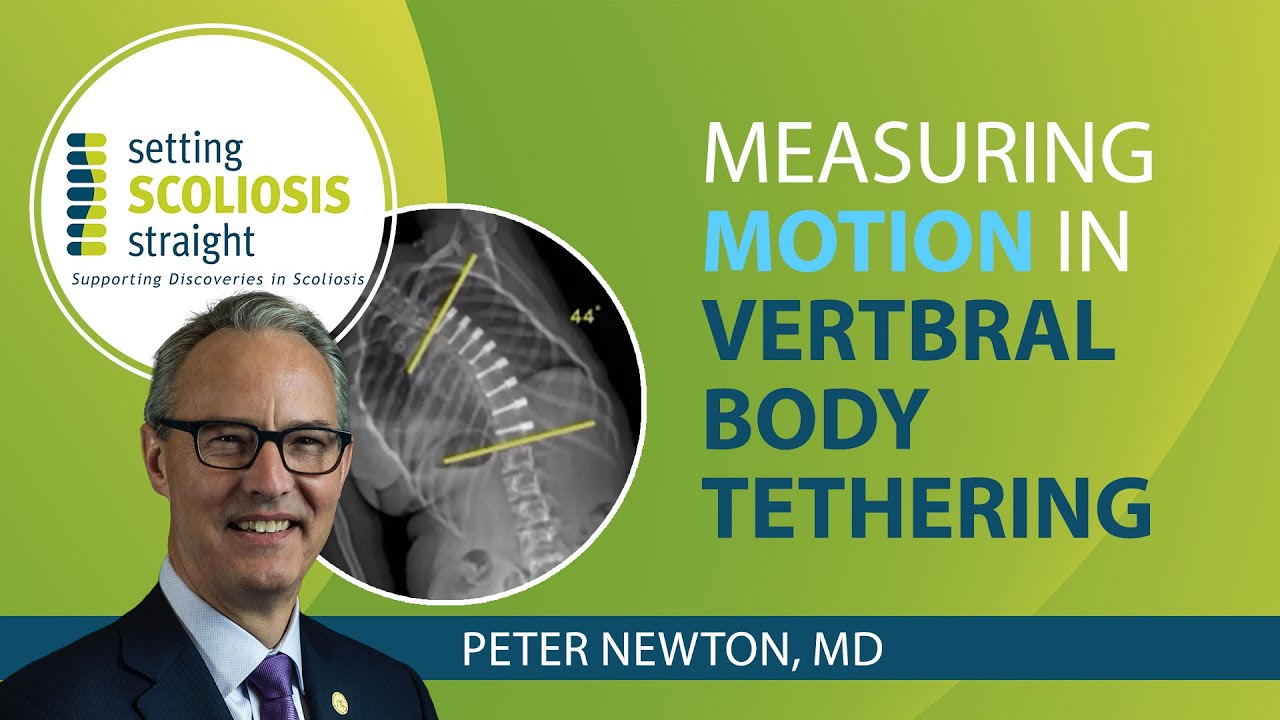 Evaluating Spinal Motion: Vertebral Body Tethering vs. Spinal Fusion ...