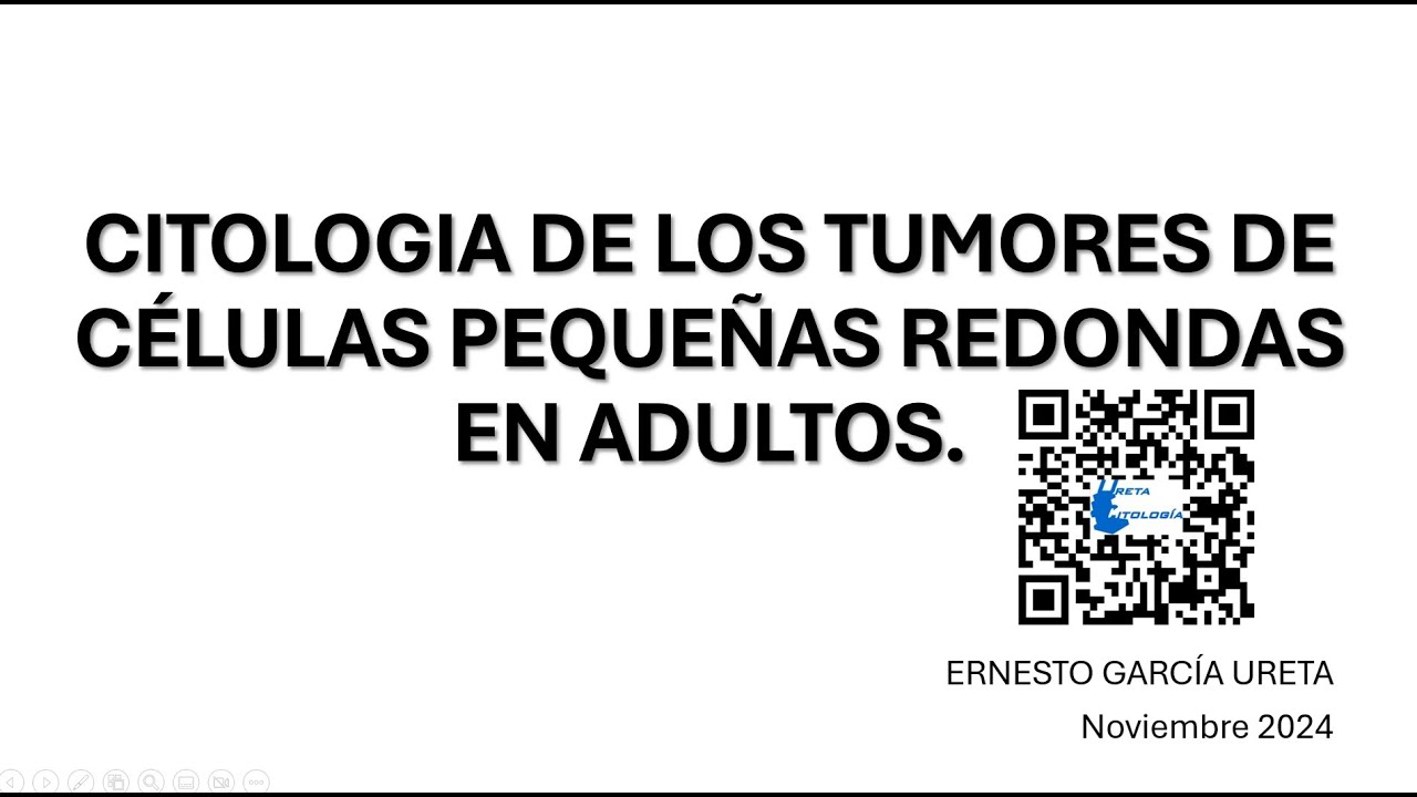 Citología de tumores de células pequeñas redondas en adultos - YouTube