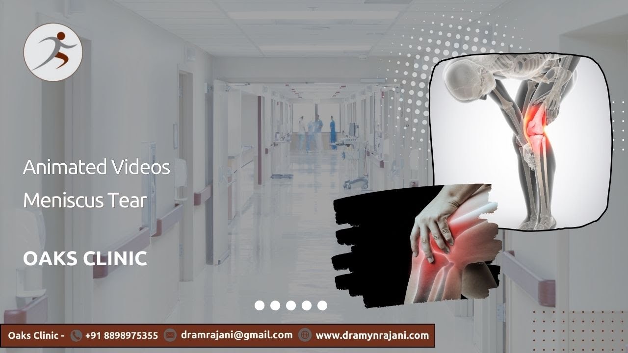 Animated Meniscus Tear Surgery | Knee Surgery | Dr. Amyn Rajani | Oaks ...