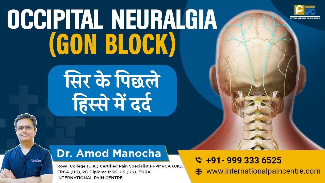 Occipital Neuralgia & GON Block / सर के पीछे का दर्द by Dr. Amod ...