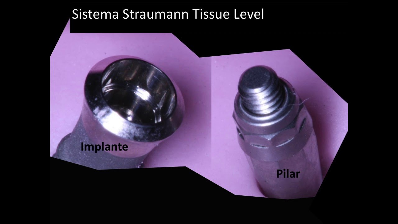 Vídeo 3 1 Diferentes Interfaces Pilar Implante - YouTube