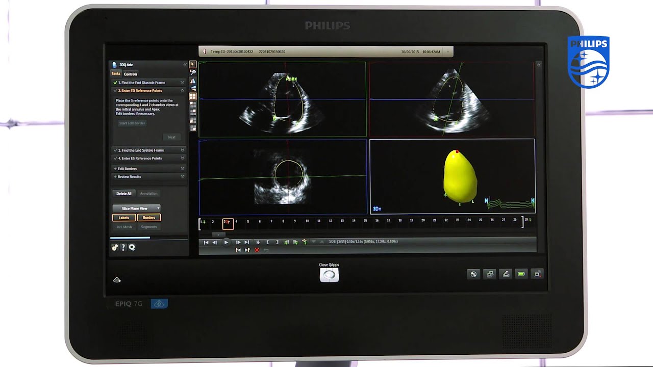 How To Perform 3D Quantification Using Philips QLAB 3DQA Application ...