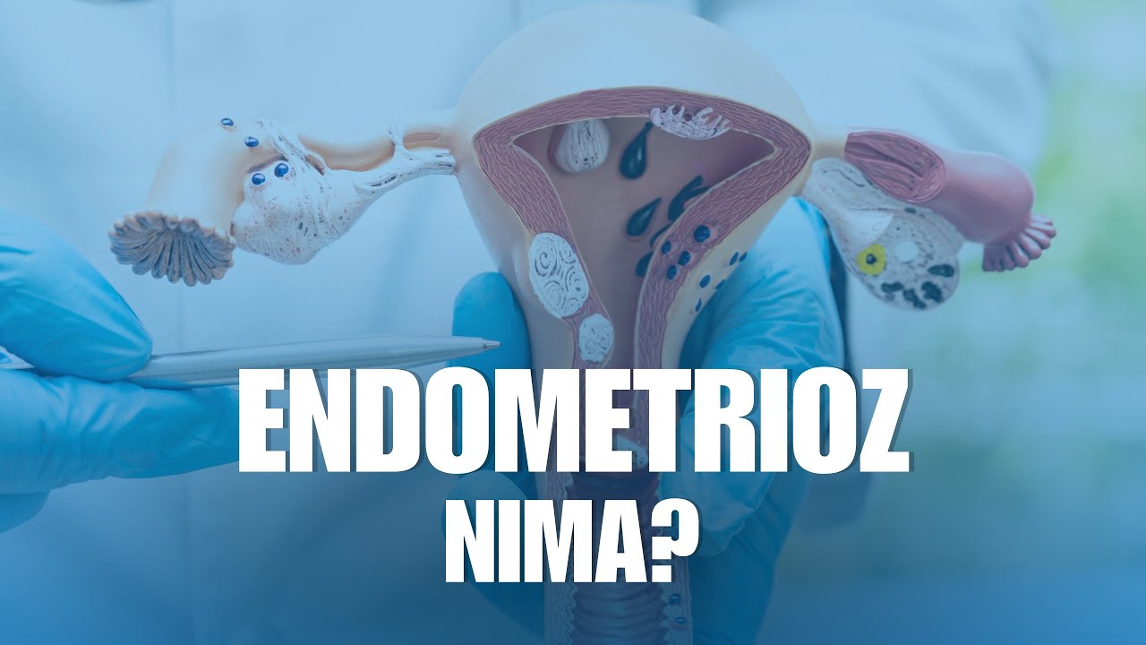 ENDOMETRIOZ NIMA? - MIRZAAHMEDOVA NARGIZ ALISULTANOVNA JAVOB BERADILAR ...
