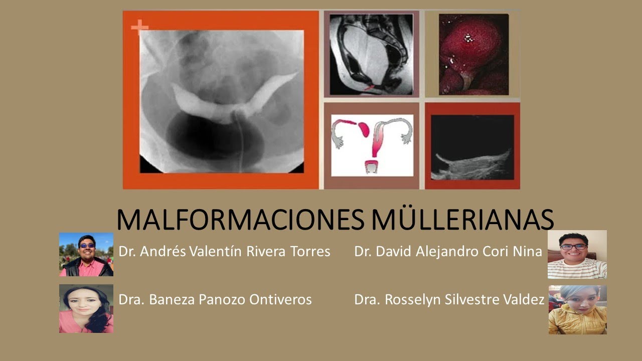 Malformaciones Müllerianas Diplomado en Ecografía Abdominal y ...