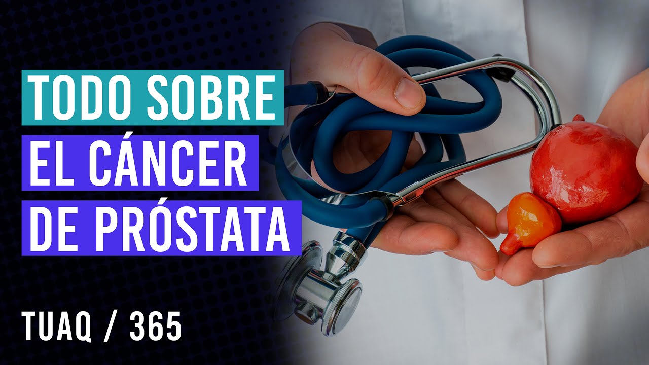 Todo lo que debes saber sobre el cáncer de próstata - YouTube