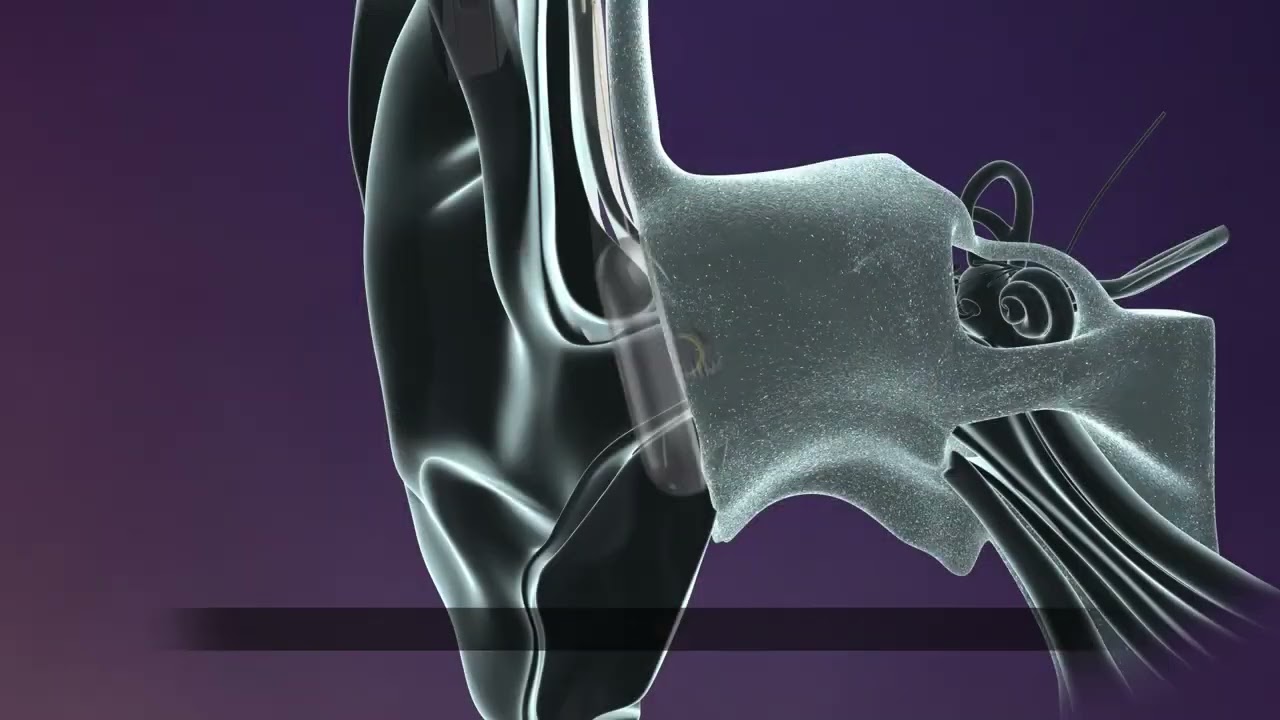 How The Osia® System Works - YouTube