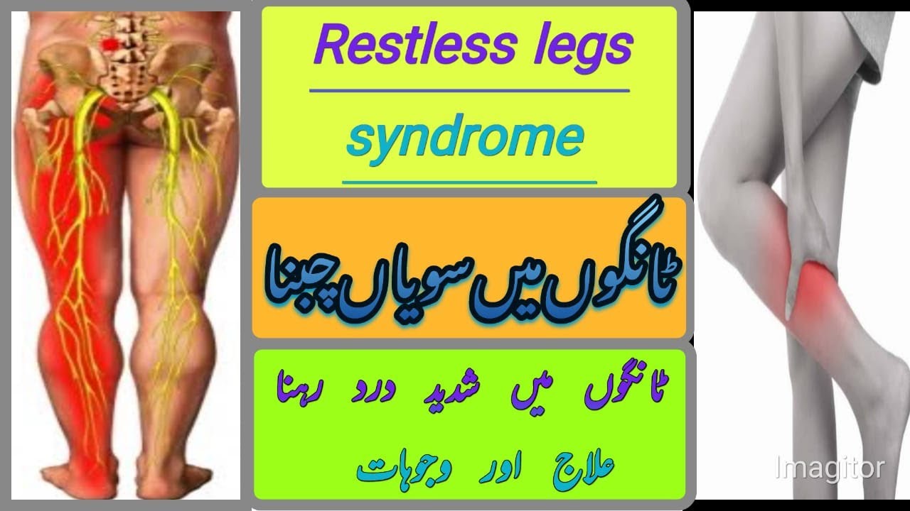 Rest less legs syndrome cause.. Diagnosis treatment . home remedies Dr ...