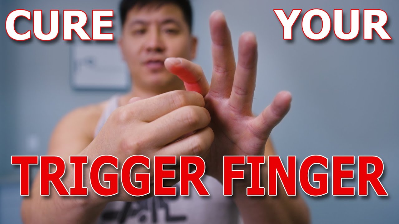 Unlocking the Solution to Trigger Finger and Trigger Thumb - YouTube