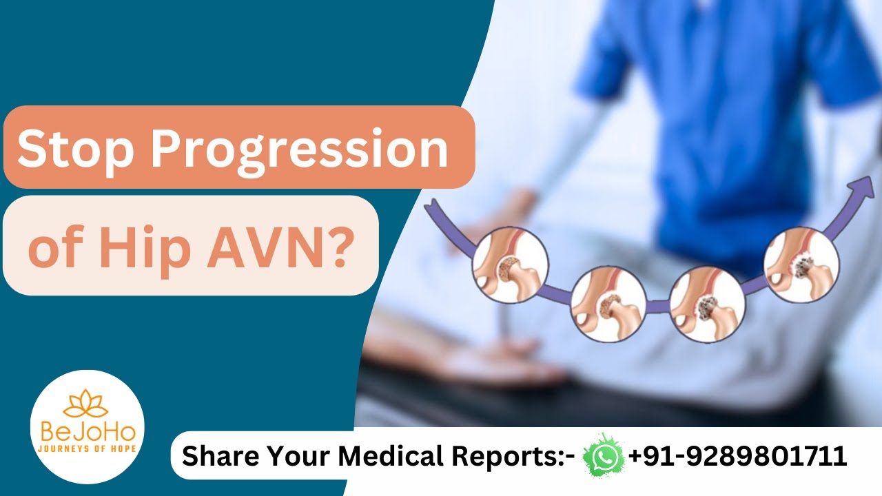 Know all about the treatment for Hip AVN. Share us your reports for a ...
