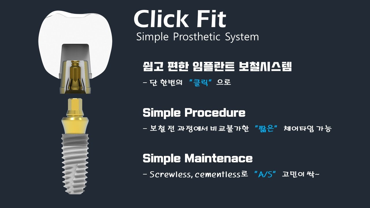ClickFit(클릭핏) | 귀로 듣는 임플란트보철 - YouTube