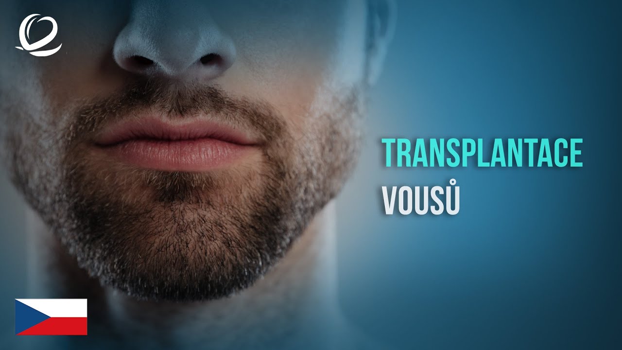 Transplantace vousů | Metody transplantace vlasů na Clinicana v ...