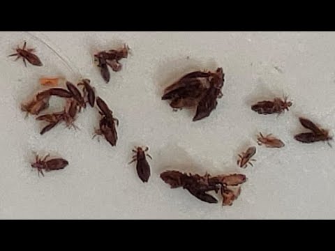 Lice & nits playing // popping lice with hands fingers Real sounds ...