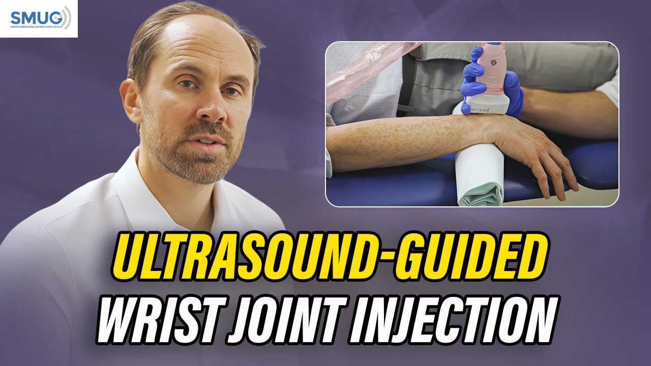 Ultrasound‑Guided Wrist Joint Injection (Radiocarpal) – Step‑by‑Step ...