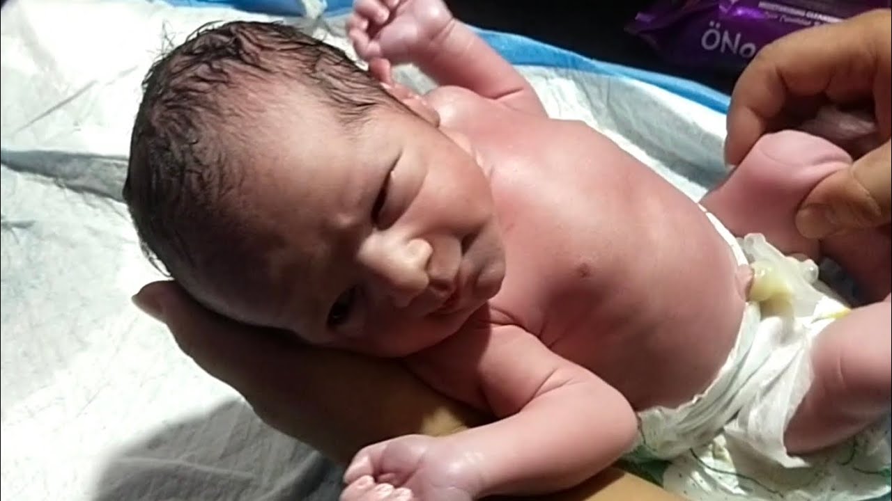 👉 “Premature Baby Just Delivered 🍼 | First Moments in NICU Care 👶 ️ ...