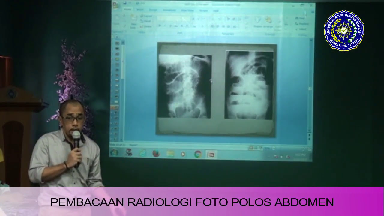 PEMBACAAN RADIOLOGI FOTO POLOS ABDOMEN - Workshop KKD FK UMSU - YouTube