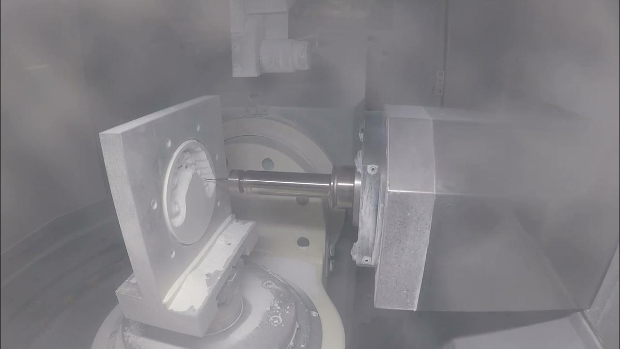 N2-5XA Crown & Bridge - YouTube