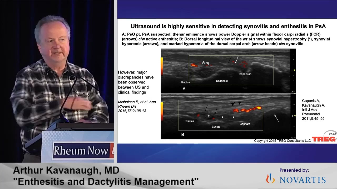RNL 2021 - Enthesitis & Dactylitis Management: Dr. Arthur Kavanaugh ...